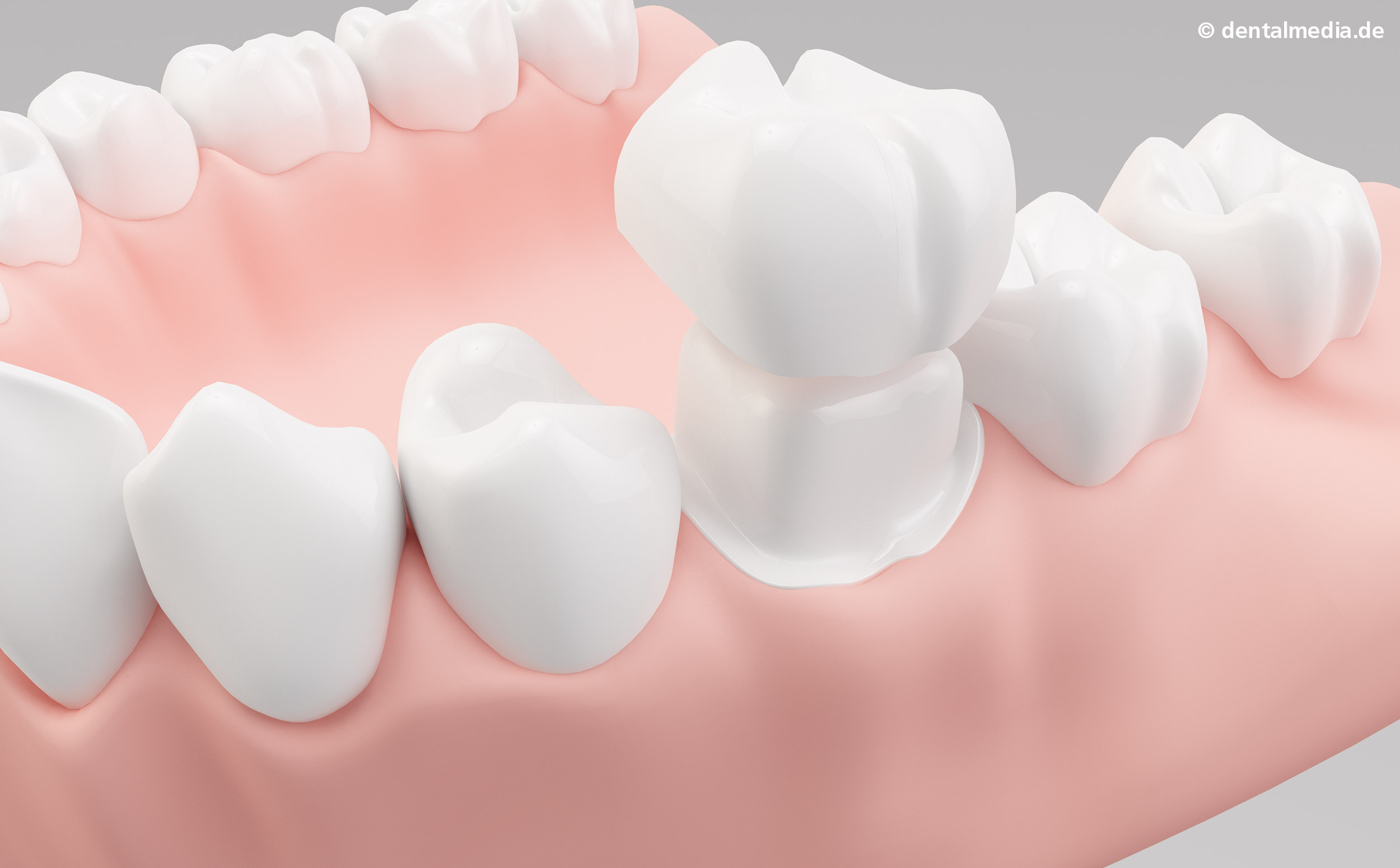 Ästhetik - Zahnheilkunde Hofheim